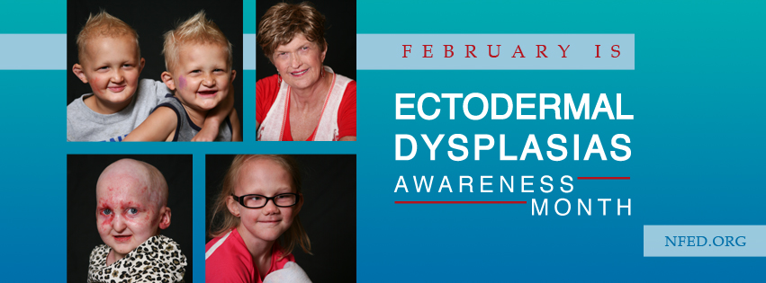 10* More Rare Ectodermal Dysplasias - NFED
