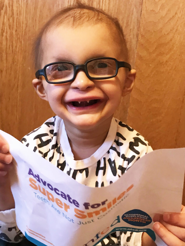 Show Us Your Super Smile - NFED