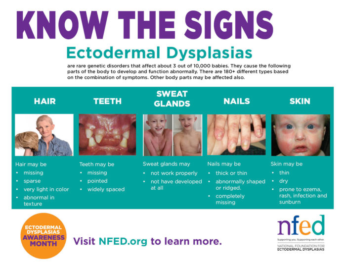 Ectodermal Dysplasias Awareness Month 2019 - NFED