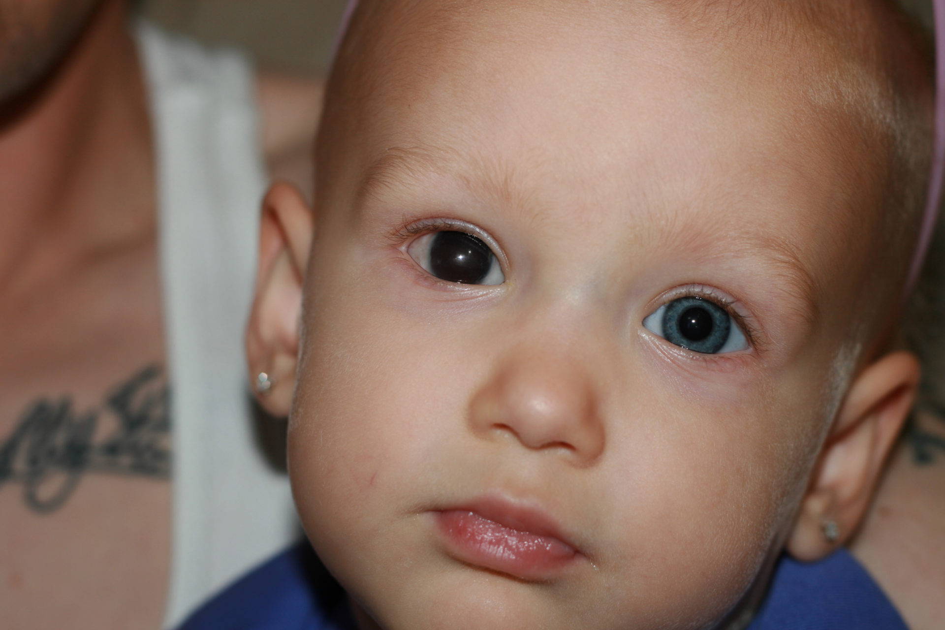 What You Need To Know To Help Your Child's Vision If They Have IP - NFED