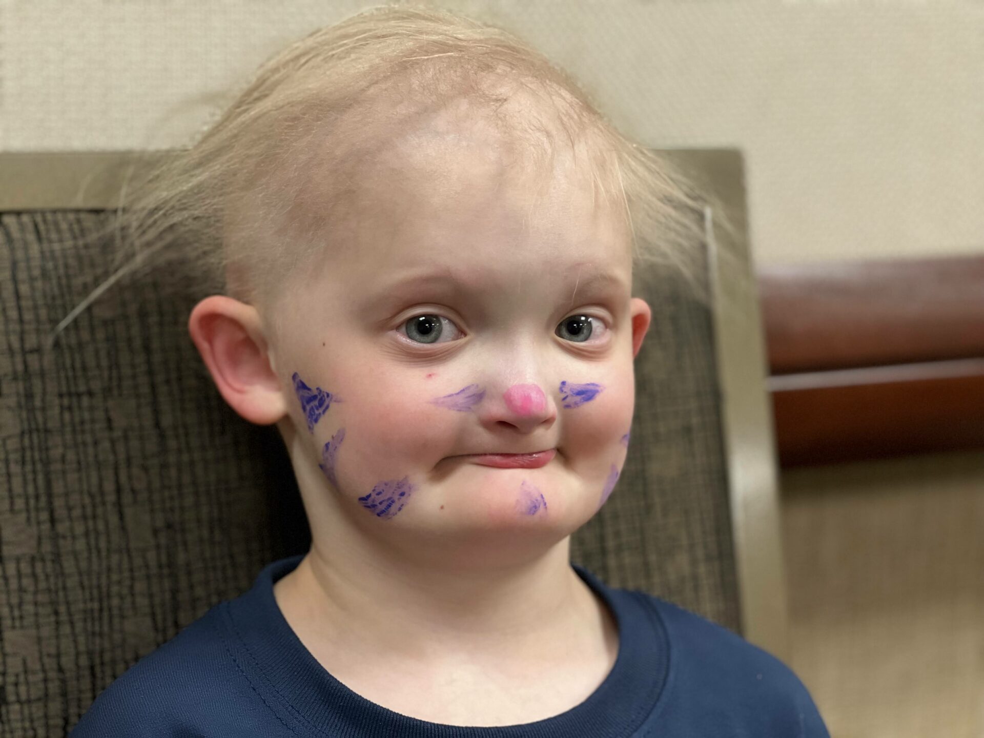 Raising a Strong Daughter with HED - NFED