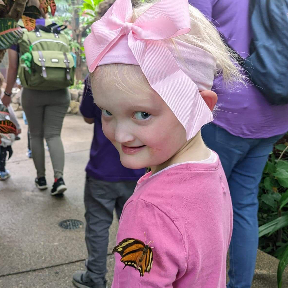 National Foundation for Ectodermal Dysplasias | NFED