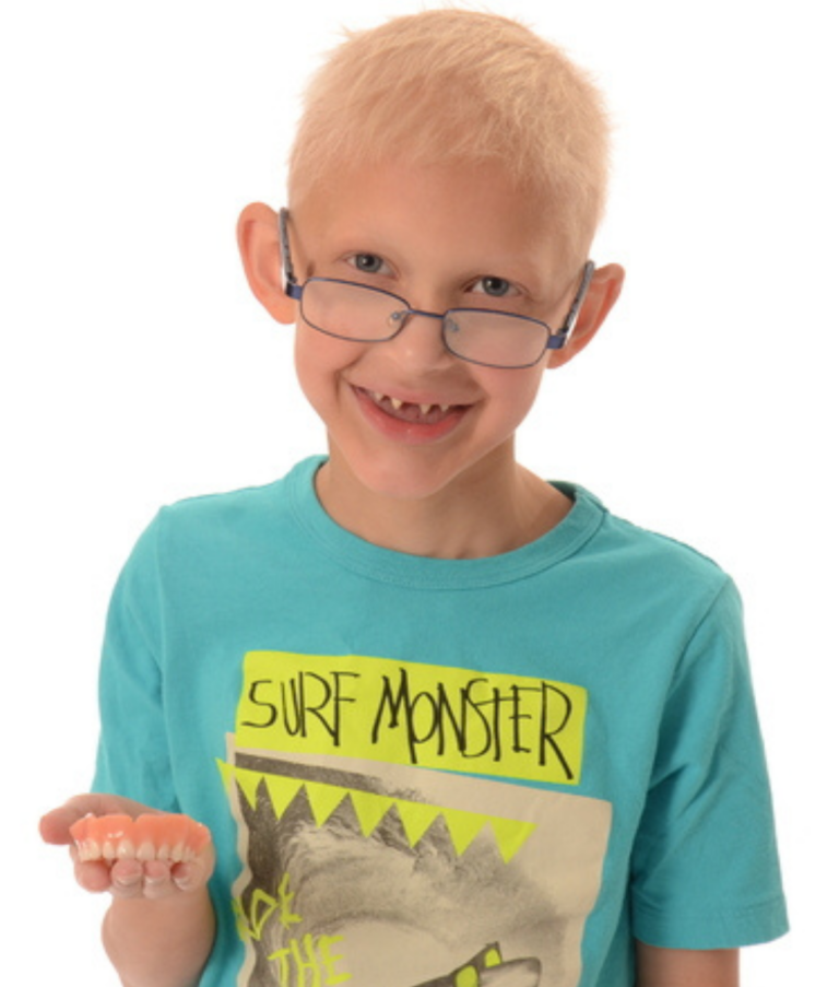 National Foundation for Ectodermal Dysplasias | NFED