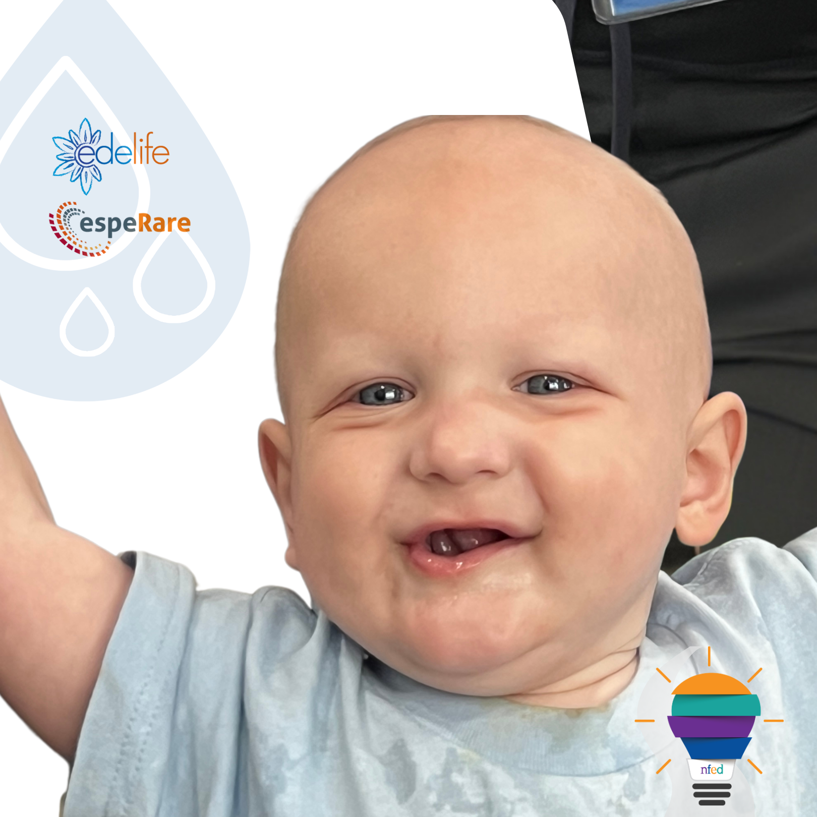 Webinar: Edelife Clinical Trial for XLHED - NFED